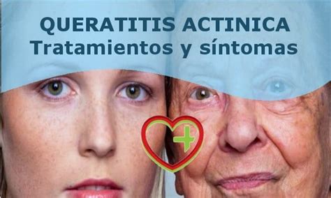 Queratosis Actínica Diagnóstico Y Tratamientos Laparafarmaciaencasa