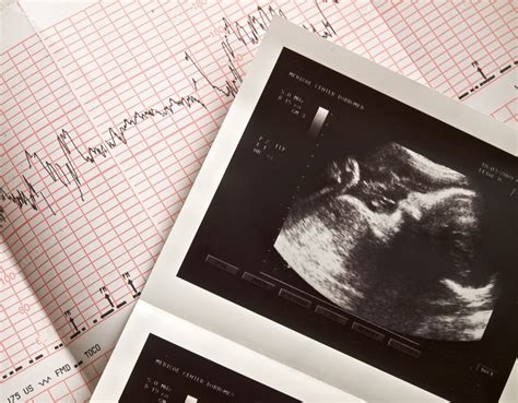 Nt Nb Scan Procedure Price And Benefits Dr Mona Dahiya