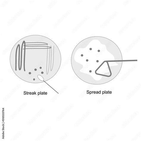 The Pure Culture Technique Streak And Spread Plate With Sterilize Loop