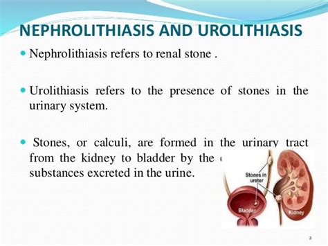 Nephrolithiasis
