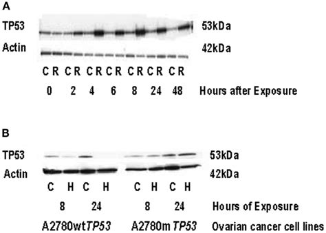 Tp53 Protein Expression In Ovarian Cancer Cell Lines Following
