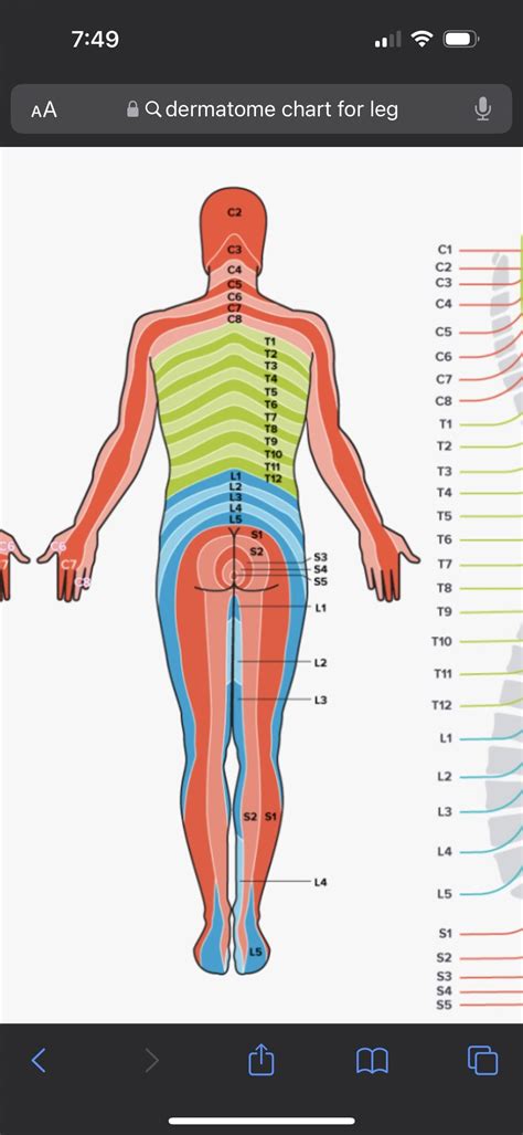 Can Anyone Relate R Sciatica