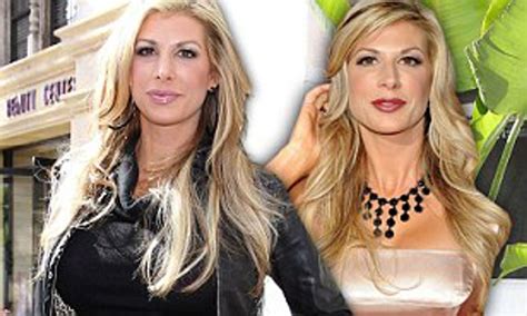 Alexis Bellino Before And After