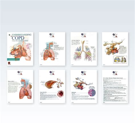 Understanding Copd Flip Chart 11x14 Clinicalposters