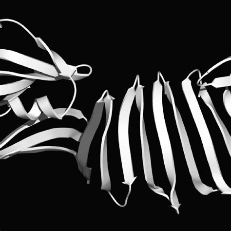 Fibroid Nodules On The Sole Of The Foot In The Same Patient Download Scientific Diagram