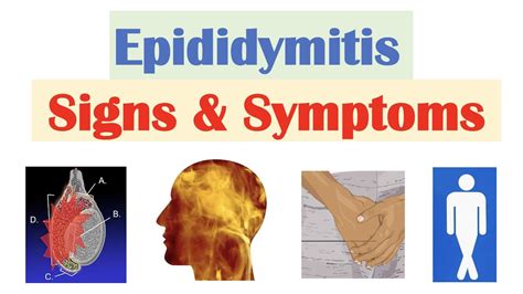Can Cycling Cause Epididymitis At Phyllis Mosier Blog