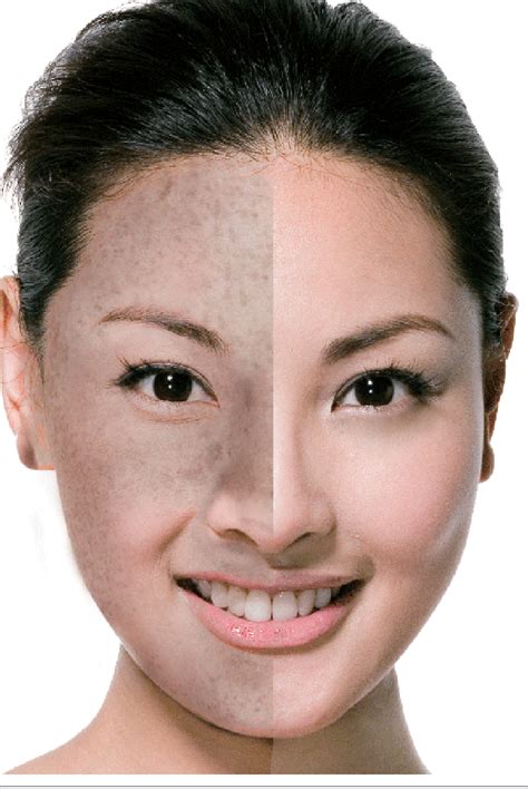 皮膚乾燥皮膚乾燥原理介紹概述症狀原因標誌原因護理方案保濕材料保濕方中文百科全書