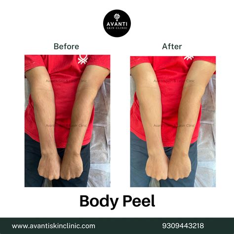 Skin Pigmentation Symptoms Causes Types And Disease Links