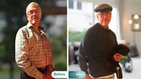 Defeat Diabetes Program James G