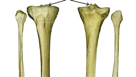 Appendicular Skeleton Bone Markings Flashcards Quizlet