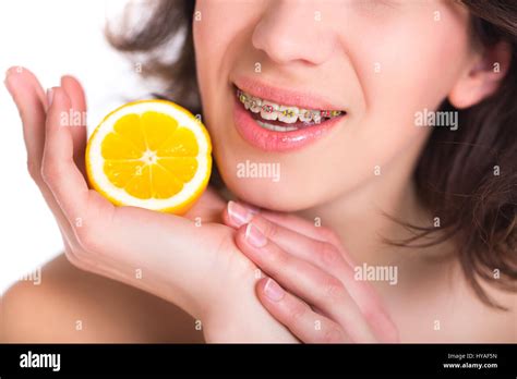 Studio Portrait Of A Girl With Multi Colored Braces Isolated On White