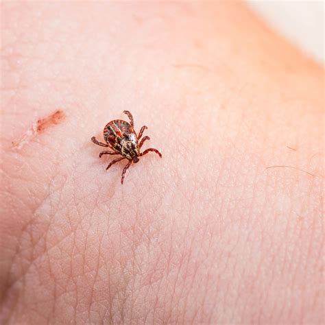Acariens Visibles Ou Invisibles Tout Ce Quil Faut Savoir