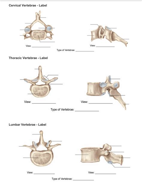 Solved Cervical Vertebrae Label View Type Of Vertebrae