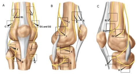Effective Knee Pain Relief Genicular Nerve Ablation Explained Red