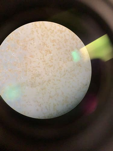 Fungi Lab Flashcards Quizlet