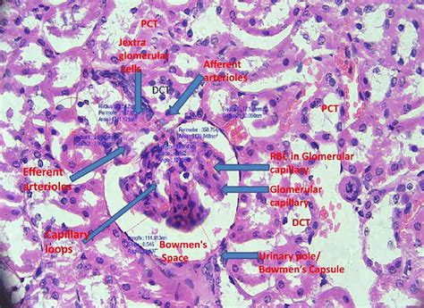 Figure 1 Glomerular Integrity Based On Histological Architecture H