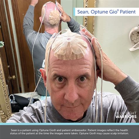 Optune Gio Us Hello Im Sean I Am Taking Over The Facebook