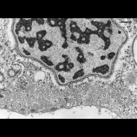 Cil9911 Opercularia Ncbitaxon168247 Opercularia Coarctata Cell