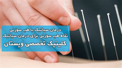 لاغری با طب سوزنی و فواید و 6 عوارض لاغری با طب سوزنی