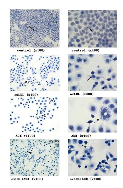 Morphology Of Eca 109 Cell Apoptosis In Light Microscopy Magnification Download Scientific