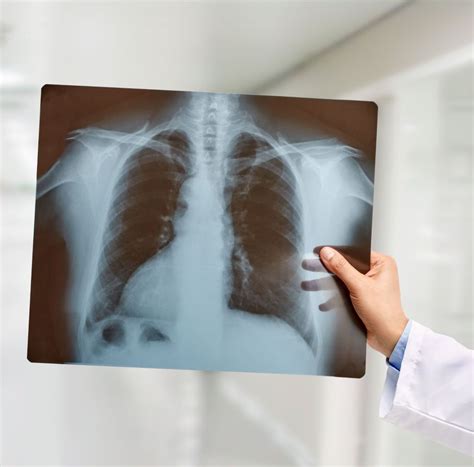 What Are The Latest Advancements In Lung Nodule Treatment Dr Mohan