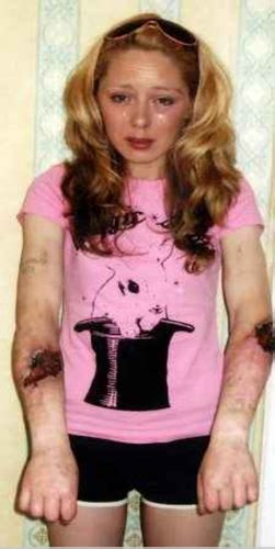 Epc Substance Misuse Flashcards Quizlet