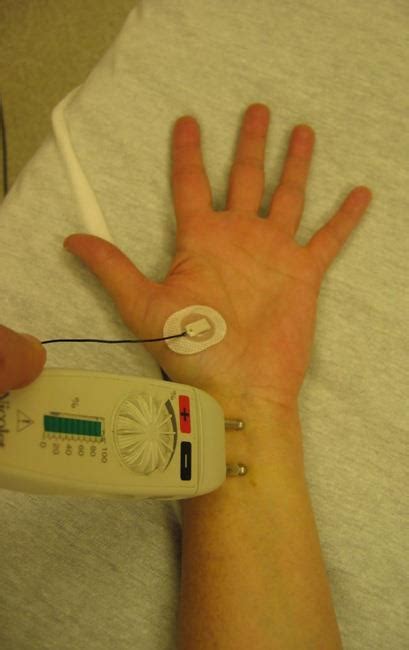 Carpal Tunnel Syndrome Symptoms And Treatment Orthoinfo Aaos
