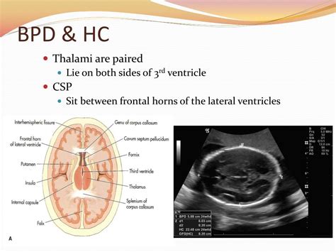 Ppt Obstetrical Measurements 2 Nd And 3 Rd Trimester Powerpoint Presentation Id2264250