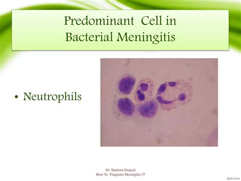 How To Diagnose Meningitis In The Lab Pptx