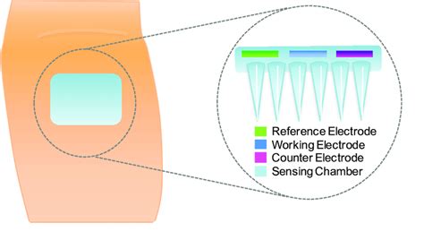 Schematic Of The Microneedle Glucose Sensing Patch On The Forearm