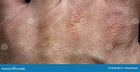 Human Hand Male Skin Pattern Dermatology Background Health Skin