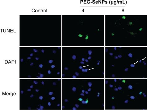 Representative Photomicrographs Of Dna Fragmentation And Nuclear
