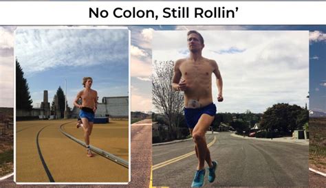 Ulcerativecolitis Ileostomy Ostomy Stoma Collin Jarvis