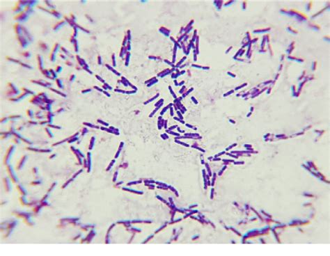 Bacillus Subtilis Microscope