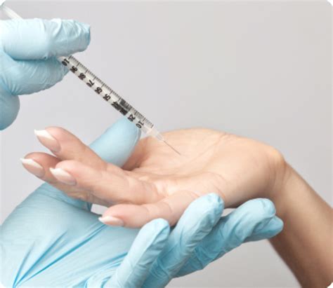 Palmar Hyperhidrosis Beverly Hills Physicians