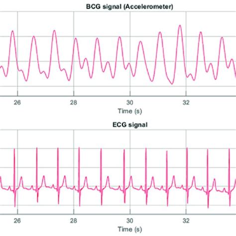 Example Of Processed Bcg Signal From Adxl355z And Ecg Signal From Psg