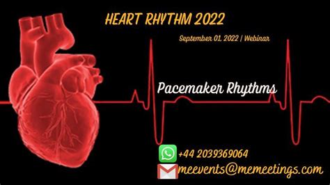 Understanding Pacemaker Rhythms Ventricular And Atrioventricular Sequential
