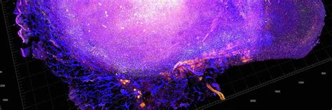 Tracking Inflammasome Activity Via Measuring Il 1β Levels With