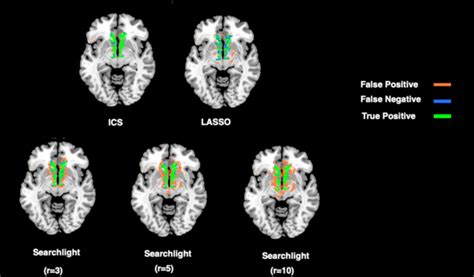 Detection Results Obtained By All Methods Using The Dataset With 25 Download Scientific
