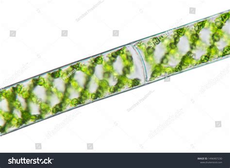 Spirogyra Under Microscope Labeled Spirogyra Under Microscope Labeled