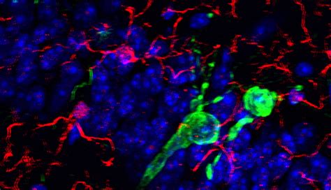 Minialz Microglia Neuron Interaction In Alzheimers Disease Bridging From Basic Research To