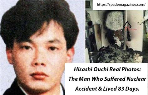 How Did Hisashi Ouchi Survive At Joel Geraldine Blog