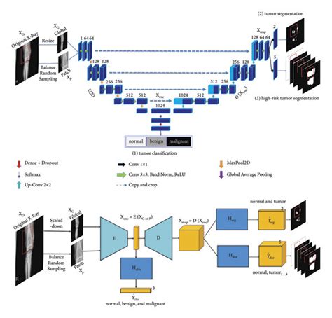 The Multilevel Seg UNet Model With Patch And Global Based Approaches Download Scientific