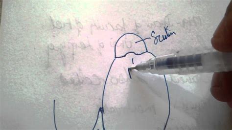 Modified Radical Mastoidectomy3gp Youtube