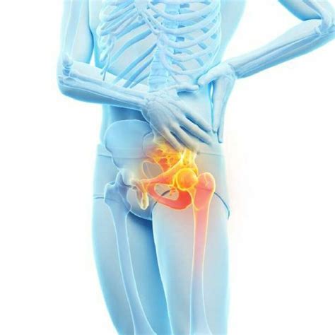 Hip Joint Inflammation Symptoms