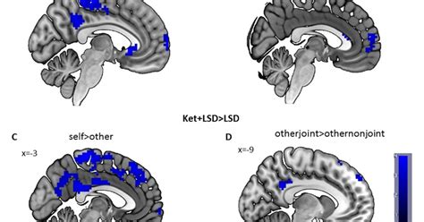 The Neuroscience Of Lsd Unlocks The Doors Of Self Perception