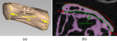 Mice Endplate Segmentation From Micro Ct Data Through Graph Based
