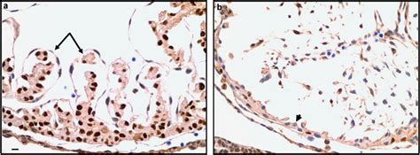 Expression Of Srf In The Developing Myocardium A A Section Of An Download Scientific Diagram