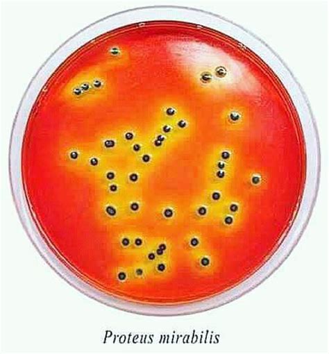Proteus Mirabilis Em Agar Sangue