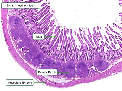 Peyers Patches In Ileum Download Scientific Diagram